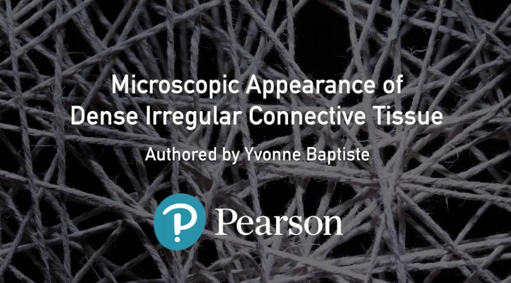 Microscopic appearance of dense regular connective tissue | Pearson+ ...