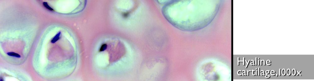 Hyaline Cartilage 400x Labeled