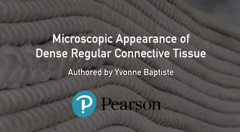 Microscopic appearance of areolar connective tissue | Pearson+ Channels
