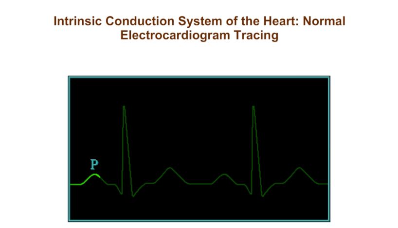 Conducting System of the Heart | Pearson+ Channels