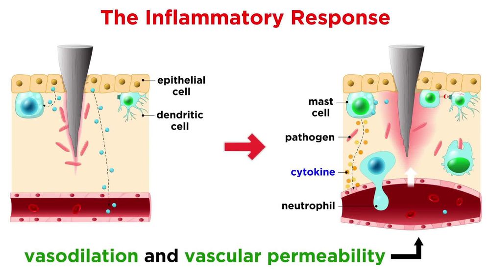 Overview of Innate and Adaptive Body Defenses | Pearson+ Channels