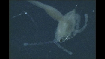 Short Video: Hydra eating Daphnia | Pearson+ Channels
